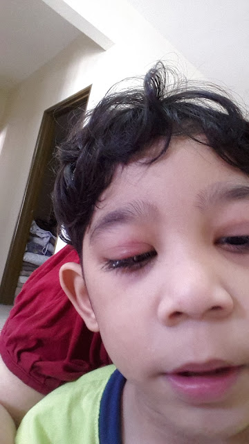 DANA: WW cengkenit ooo cengkenit