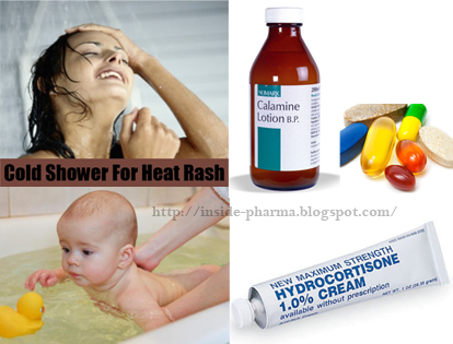 Treatments for heat rash - Its All About Pharma