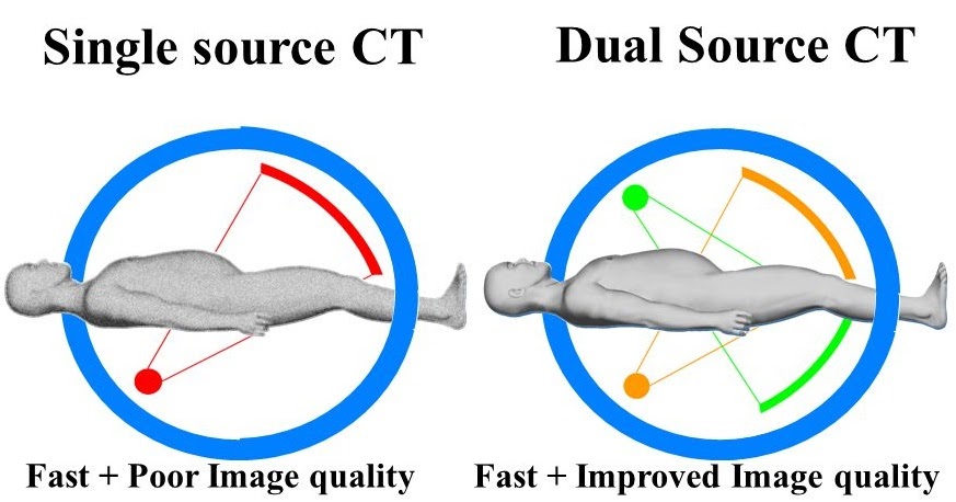 Biomedical Engineering: How Dual Source CT Becoming Promising New ...