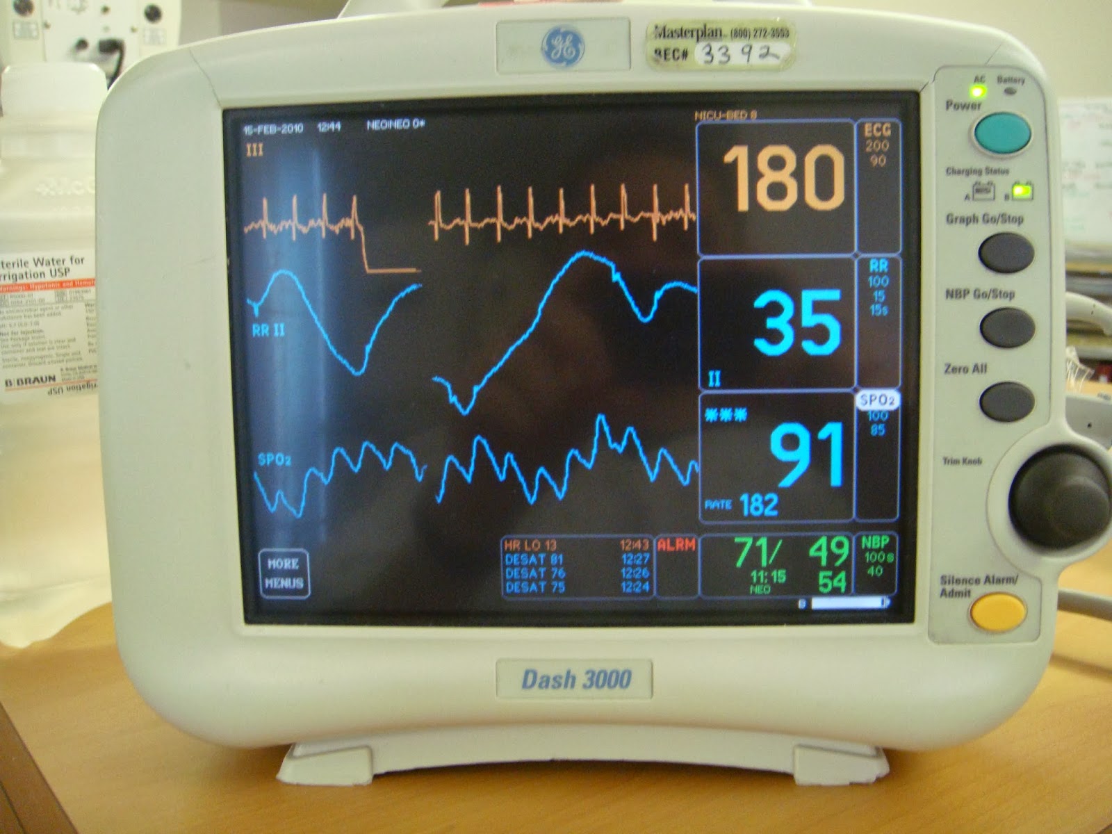 ANCHOR ENGINEERING WORKS