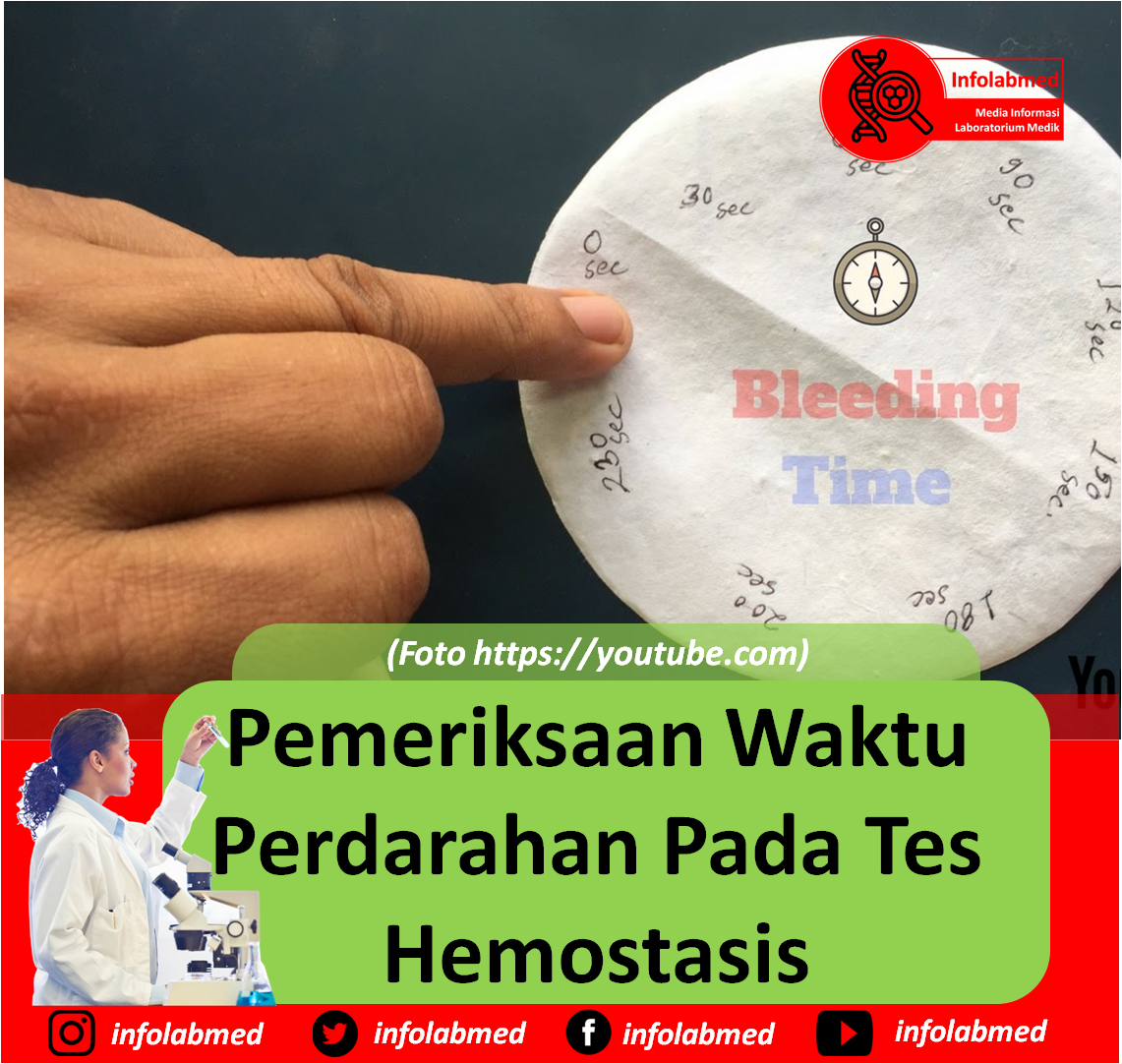 Pemeriksaan Waktu Perdarahan Pada Tes Hemostasis
