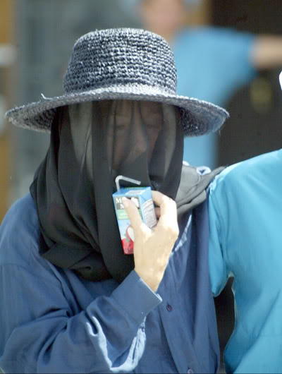 Barbara Streisand Plastic Surgery Before and After Facelift and Botox ...