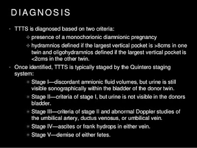 Serial Amniocentesis | Twin-Twin Transfusion Syndrome (TTTS)
