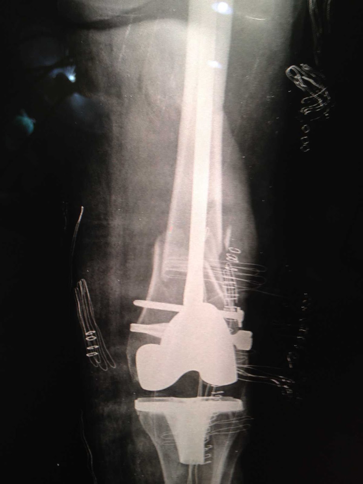 Traumatología y Cirugía Ortopédica: RODILLA