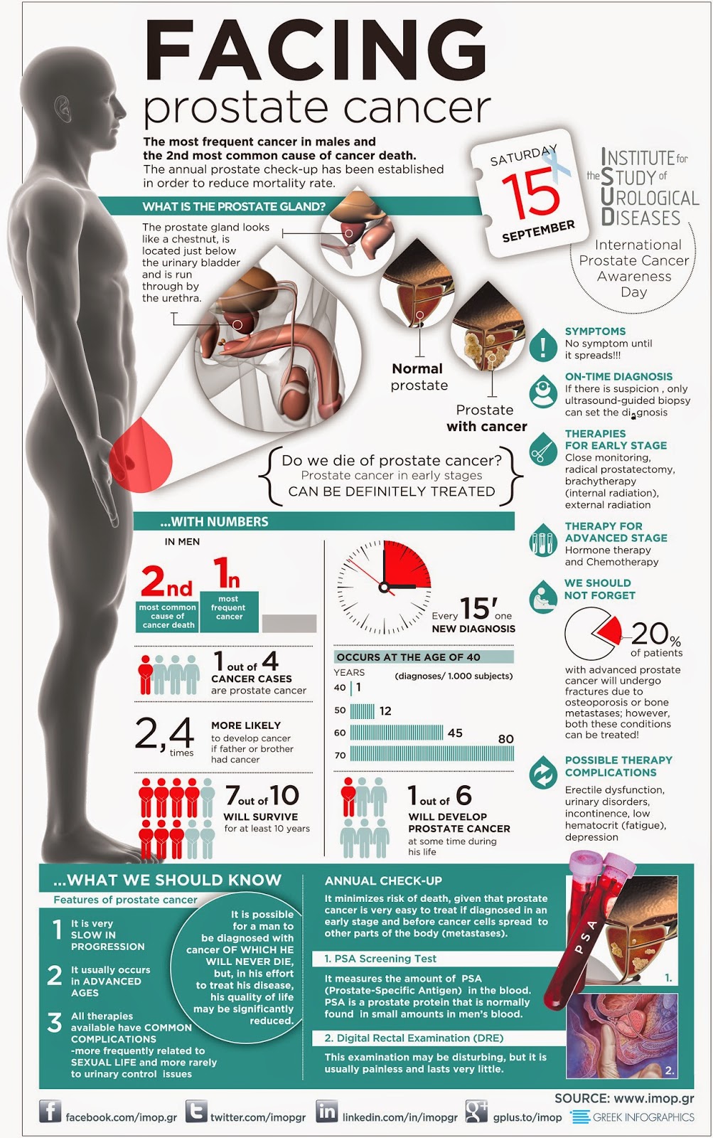 Cáncer De Próstata