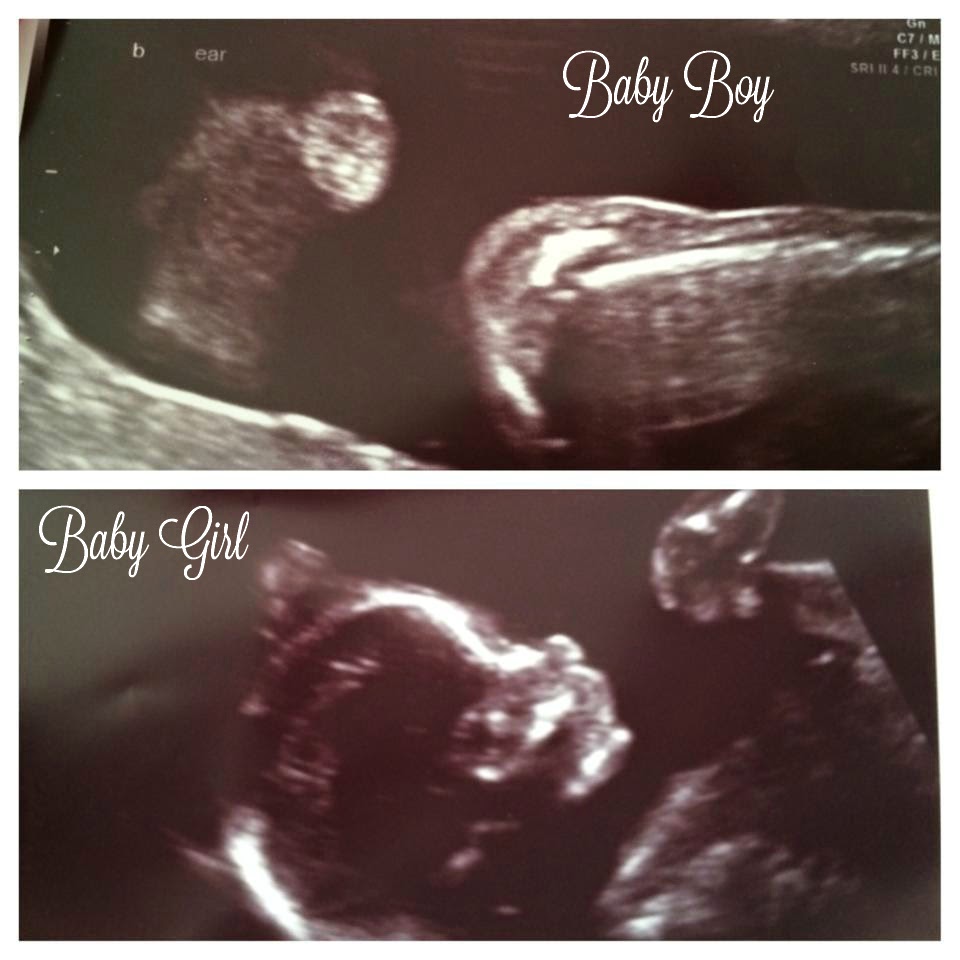 22 Weeks Ultrasound Boy