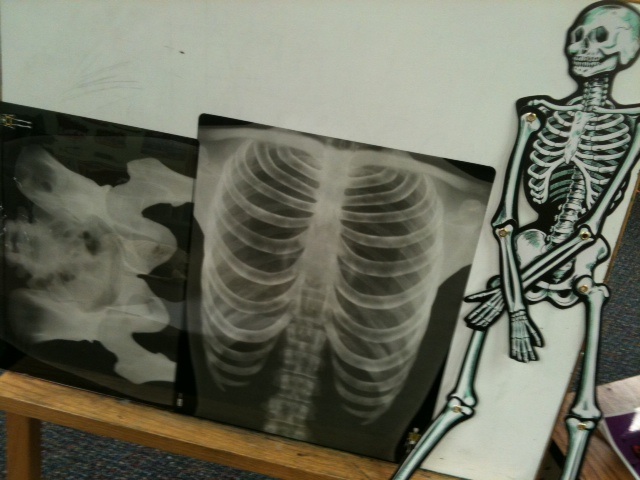 Kindergarten Kiosk: Beautiful Bones!