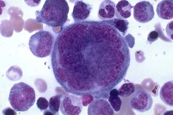 Lecture Notes in Medical Technology: Lecture #11: The Thrombocytes