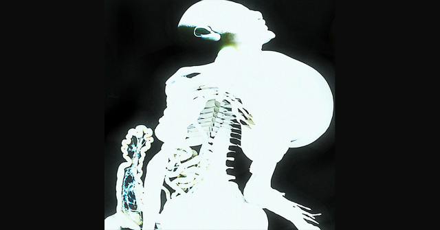 Fantasy dub: Arca - Entrañas