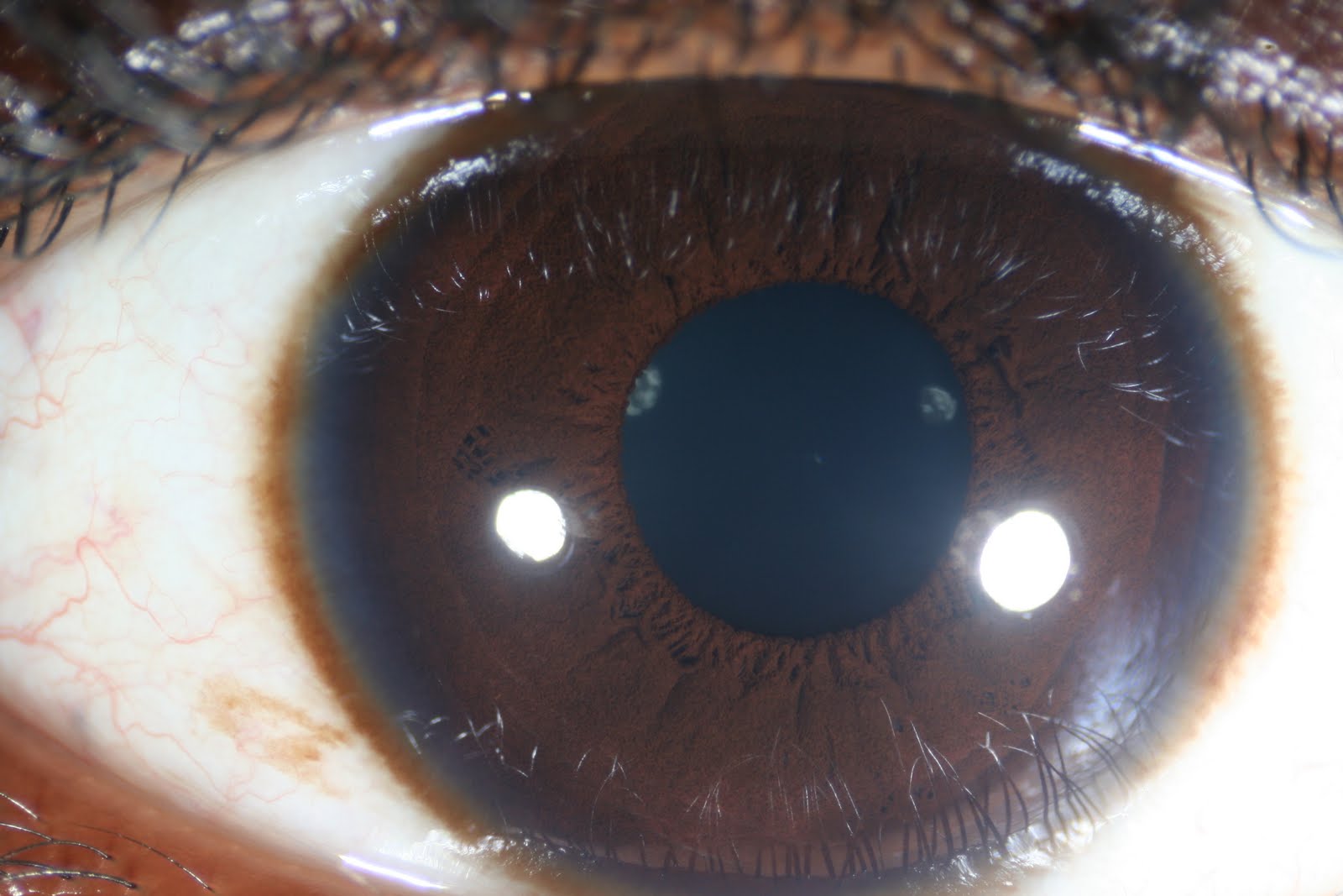 Modern & Multidimensional Iridology: Melanin Pigments at Inner ...