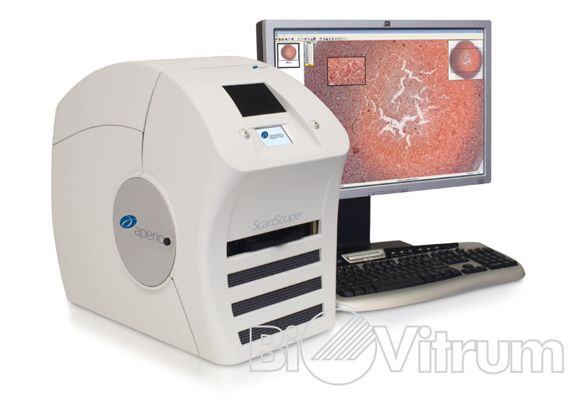 Цифровая патология: Модели сканеров Aperio