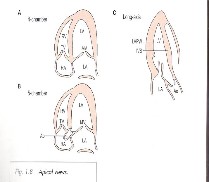 CVT Mohd Farid: Basic Echo Window :Apical View