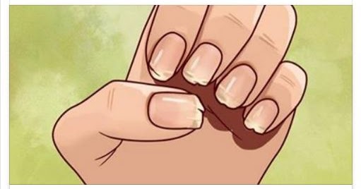 ARE YOUR NAILS ALWAYS SPLITTING OR BREAKING? HERE’S WHAT YOUR BODY IS ...