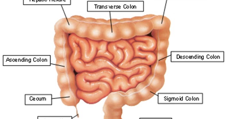 Colon Cancer Staging And Grading | How to Prevent Cancer Naturally With ...