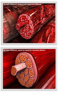 Gulsen's Medical Journal: How to Make Sore Muscles Feel Good