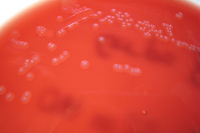 Medical Laboratory and Biomedical Science: More rapid test for Group B ...