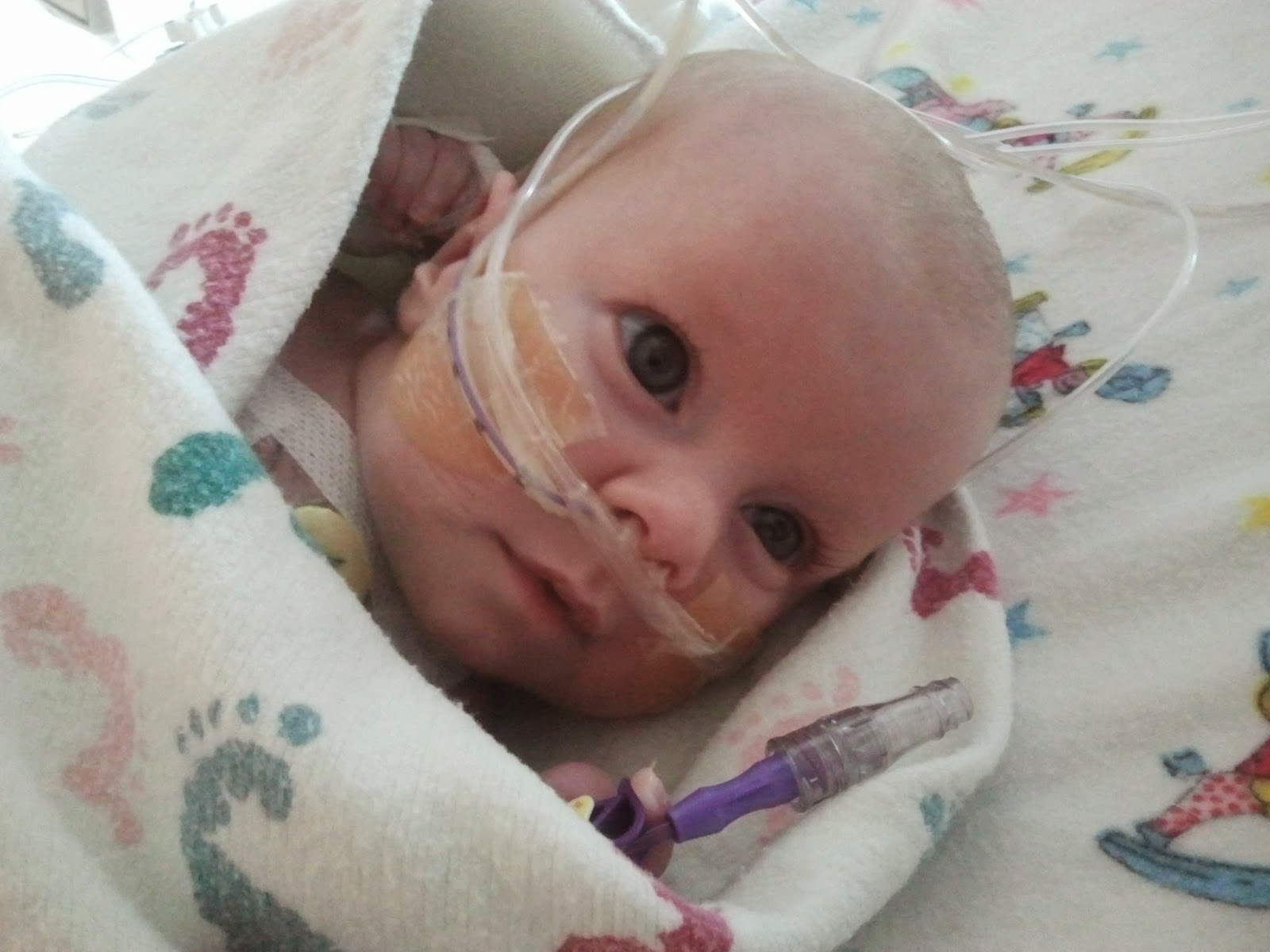 journey of a heart baby: IV Free