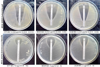 Lingam Microbiological Laboratory - The Professional Antibiotic Disk ...