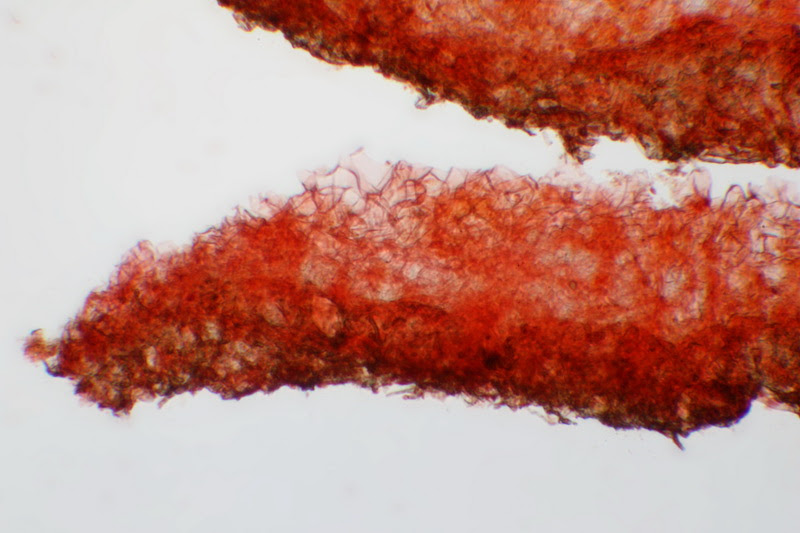 El mundo microscópico de los hongos: Gasteromicetos