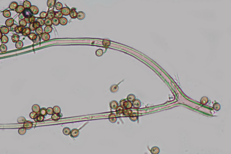 El mundo microscópico de los hongos: Gasteromicetos