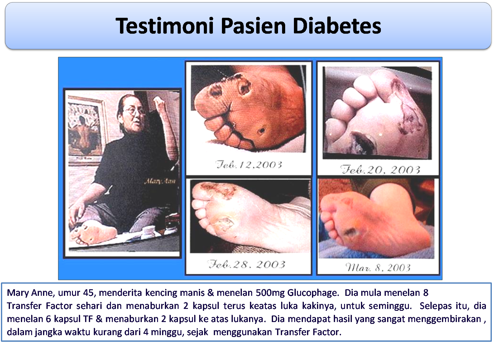 Bisnis 4life Indonesia Testimoni Pengguna Transfer Factor 4Life bisnis-4life-indonesia-testimoni-pengguna-transfer-factor-4life