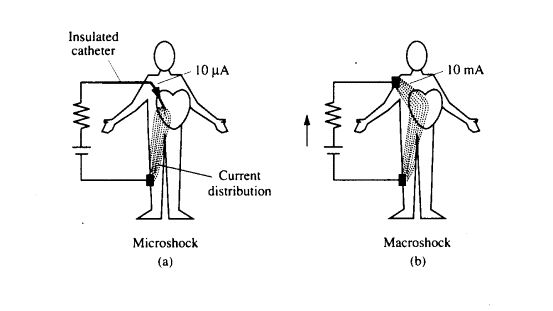 Electromédica: El macroshock y el microshock.