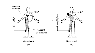 Electromédica: El macroshock y el microshock.