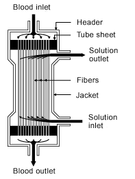 Hemodialysis Devices: Dialyzers
