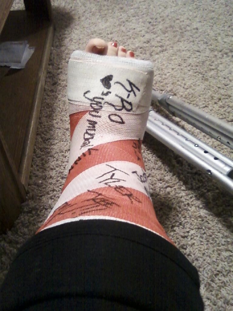 My Daily Adventures with Me and My Broken Leg: Bye Bye Candy Cane Cast!