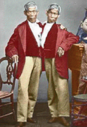 IRMÃOS SIAMESES: A origem do termo "gêmeos siameses"