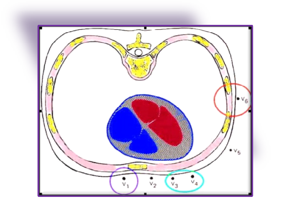 Blogmarie: ELECTROCARDIOGRAMA (ECG). Parte I