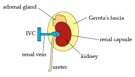 :::simple medicine:::: - TNM Staging of Renal cell carcinoma (illustrated).