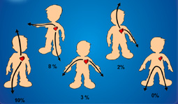 SMS: Segurança com eletricidade - Intro