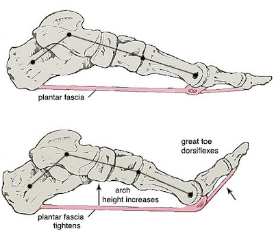 Sports Medicine & Performance: Heel Pain ~ Plantar Fasciitis & Heel ...