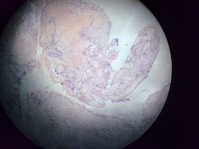 Pathophysiology in Gastrointestinal Tract - The Common Room