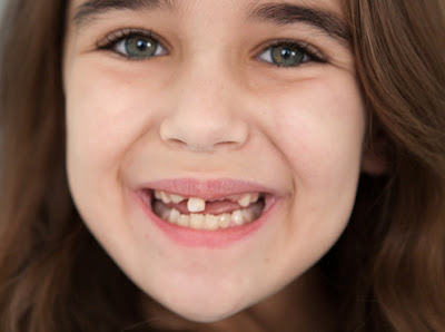 Stacy Cohen: Snaggletooth