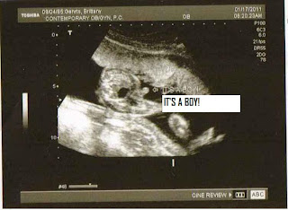 From Bump to Birth: 22 Weeks: Its a boy!!