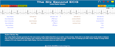 Dream Nurse Travel: The Six Second ECG Quiz