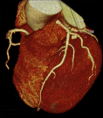 Residencia de Diagnostico por Imágenes: Anatomia Cardiaca por ...