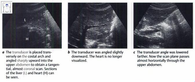 Ultrasound