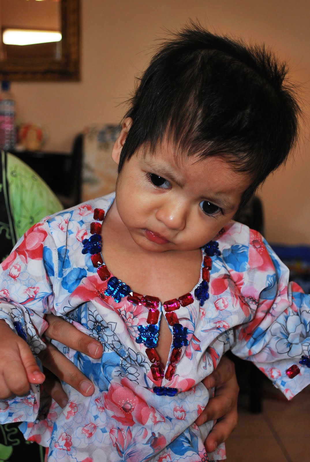 anak-anak-kita-menari-dysmorphic-child-with-global-developmental-delay
