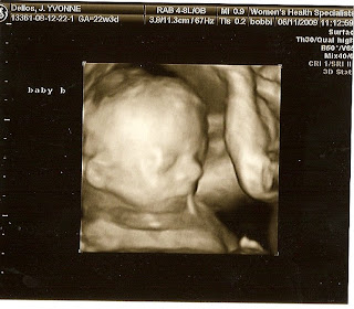 Dellos Womb Mates: 22 Weeks