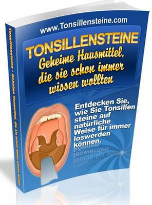 Gesundheits Blog: Mandelsteine loswerden