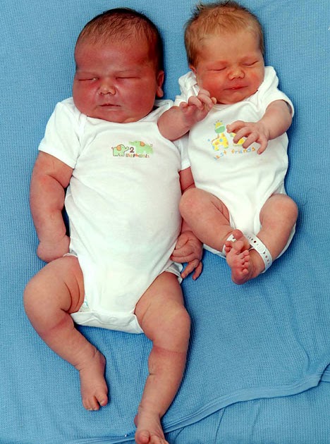 Mundo das Curiosidades: Bebé «gigante» nasce na Indonésia