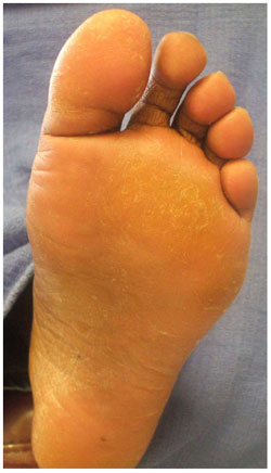 The Tundra Transition Zone: Fostering Patient Adherence in the ...