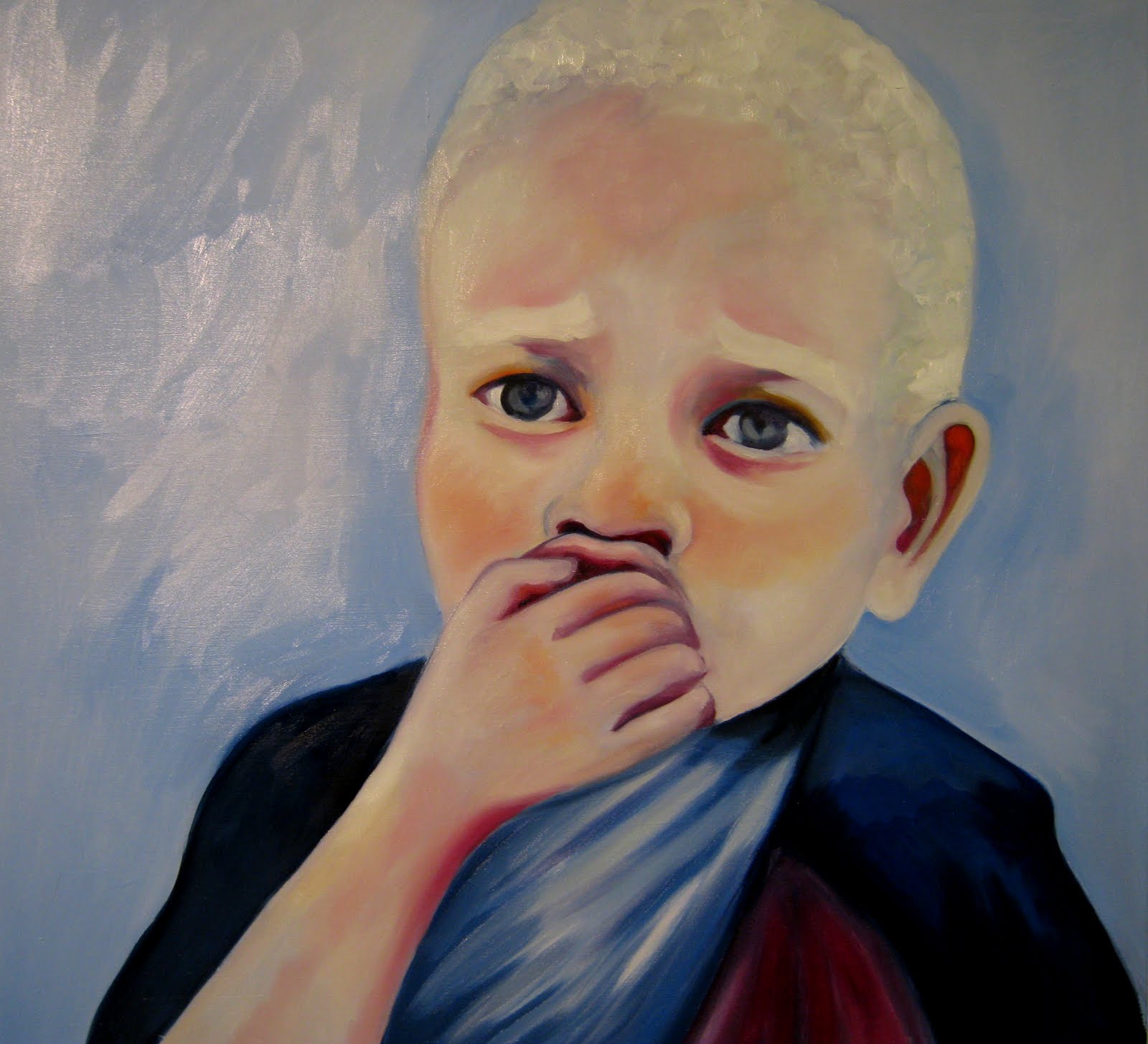 Tessa Cameron: Albino Portrait Series