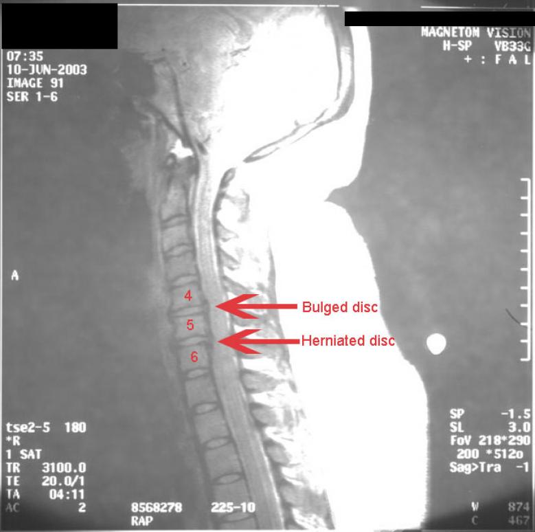RHB and Physical Medicine: RHB of soft tissue and musculoskeletal ...