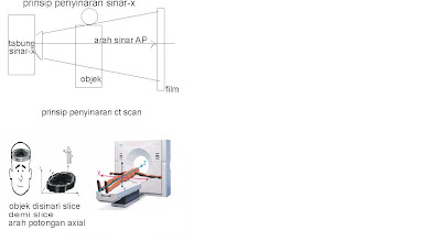 Radiologi: Perkembangan CT Scan