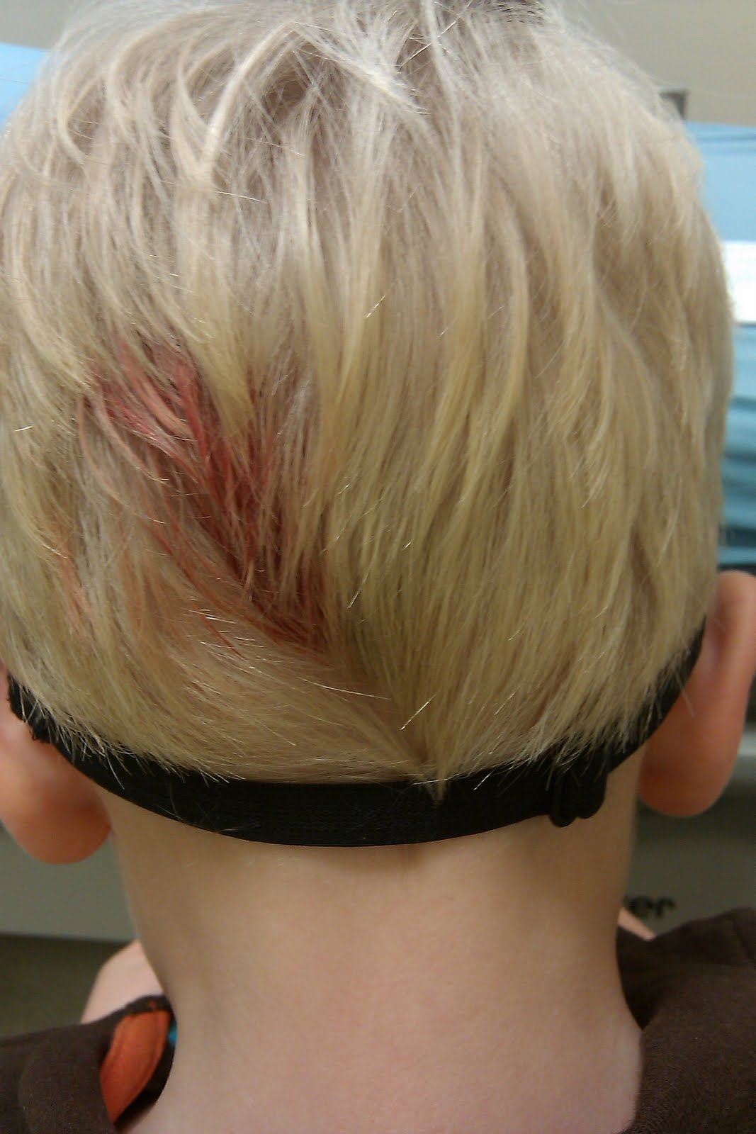 Away We Go: The Day My Kid's Head Got Stapled Shut