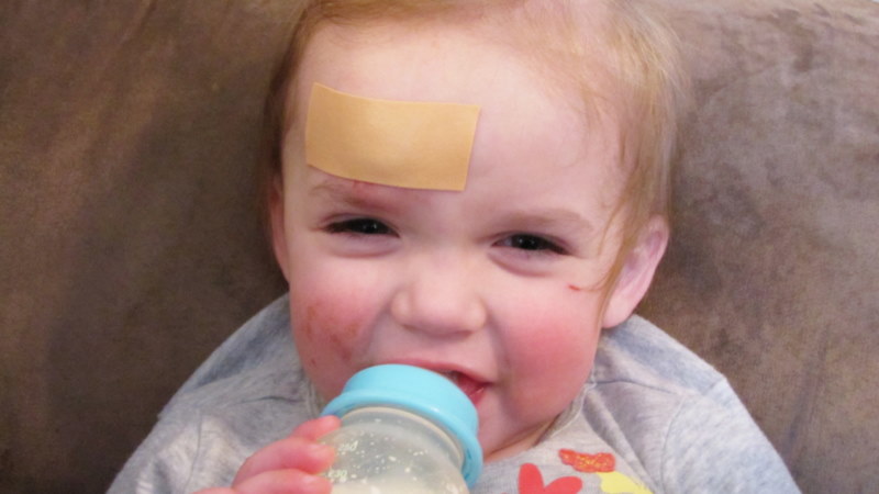 A big bad boo-boo. » Jasnchell